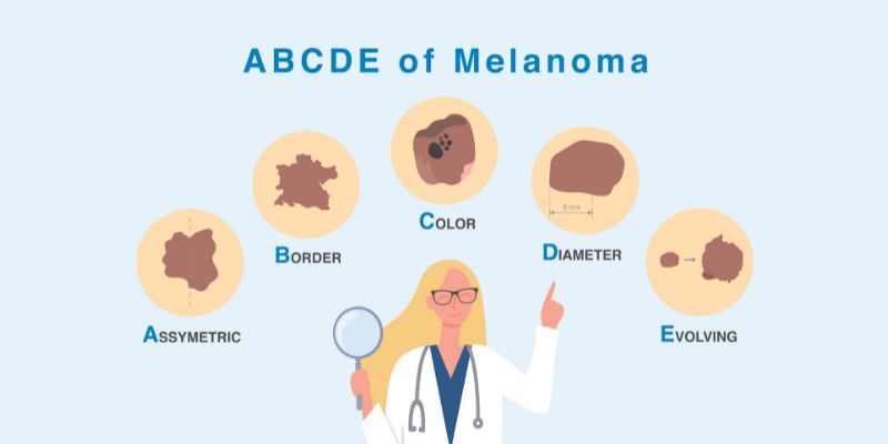 Melanoma Awareness Month: Know Your Risk
